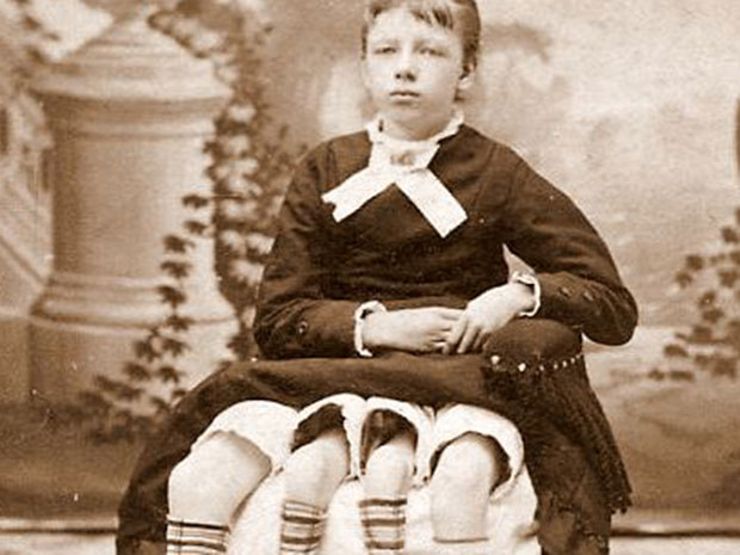 The Fascinating True Stories Behind 10 Famous ‘freak Show Performers